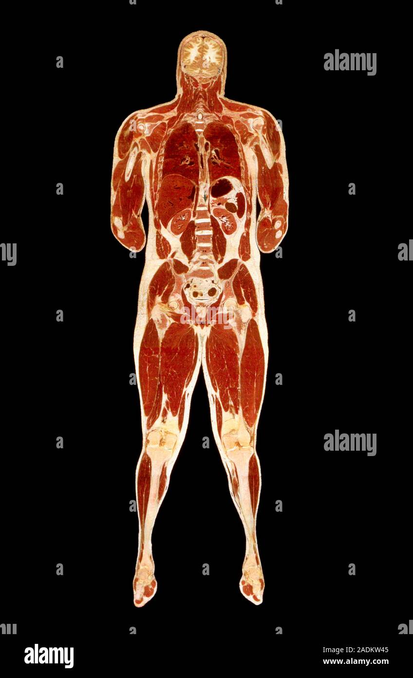Male body sectioned. Front view of the male human body, sliced through ...