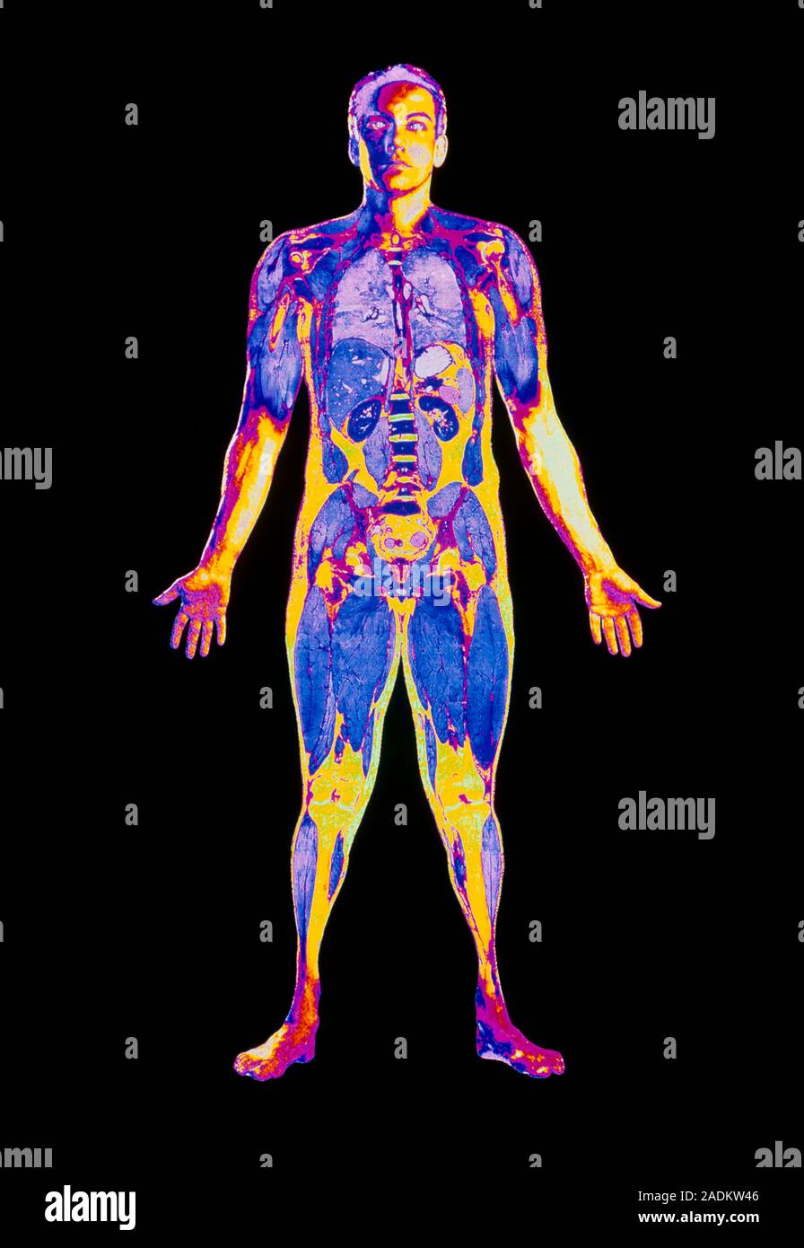 Male body sectioned. Computer coloured front view of the male human ...
