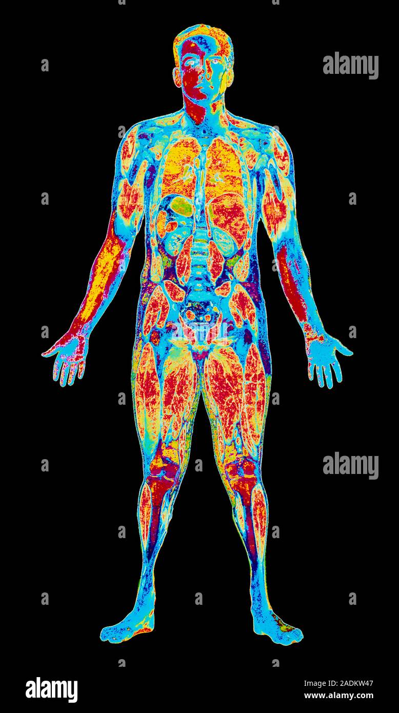 Male body sectioned. Computer coloured front view of the male human ...