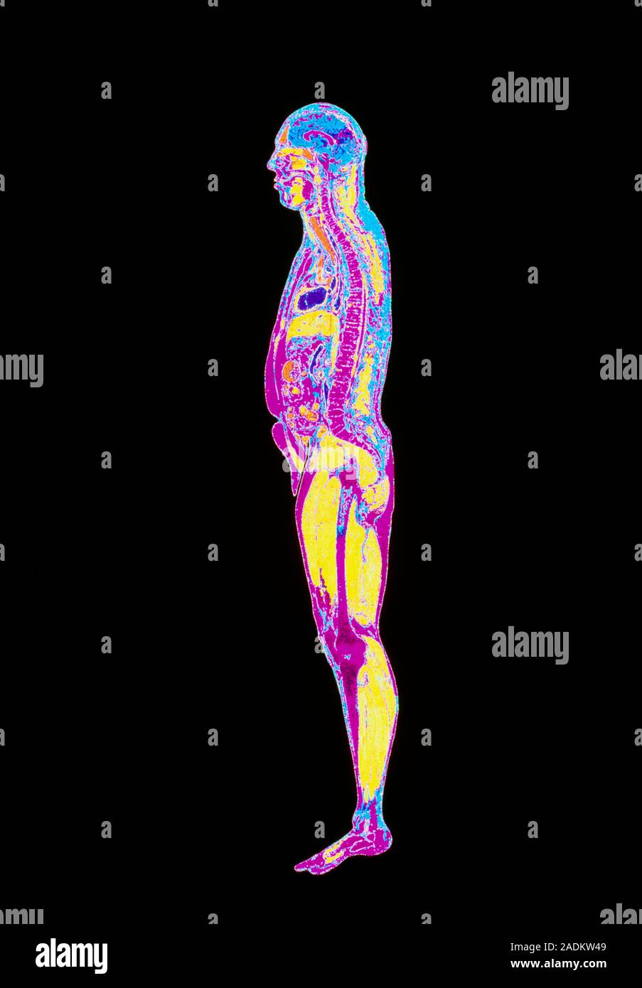 Male body sectioned. Computer coloured side view of the male human body ...