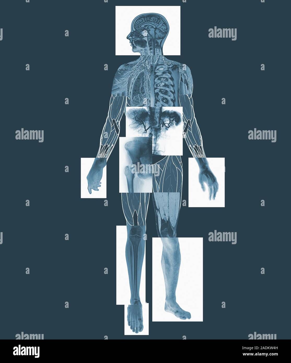 Body imaging. Composite image of several methods used to visualise the ...