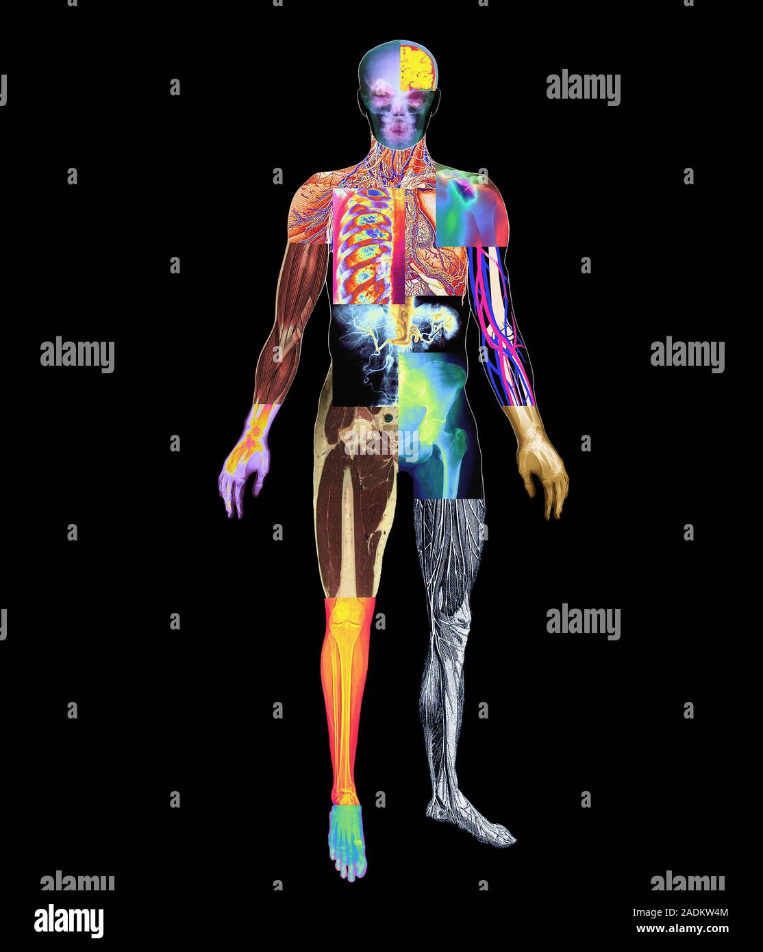 Body imaging. Composite image of several methods used to visualise the ...