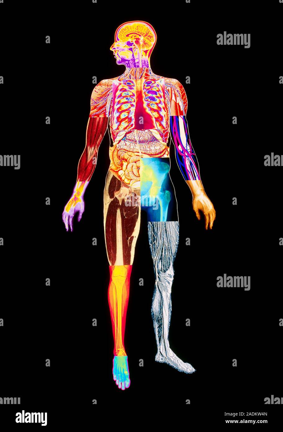 Body imaging. Composite image of several methods used to visualise the ...