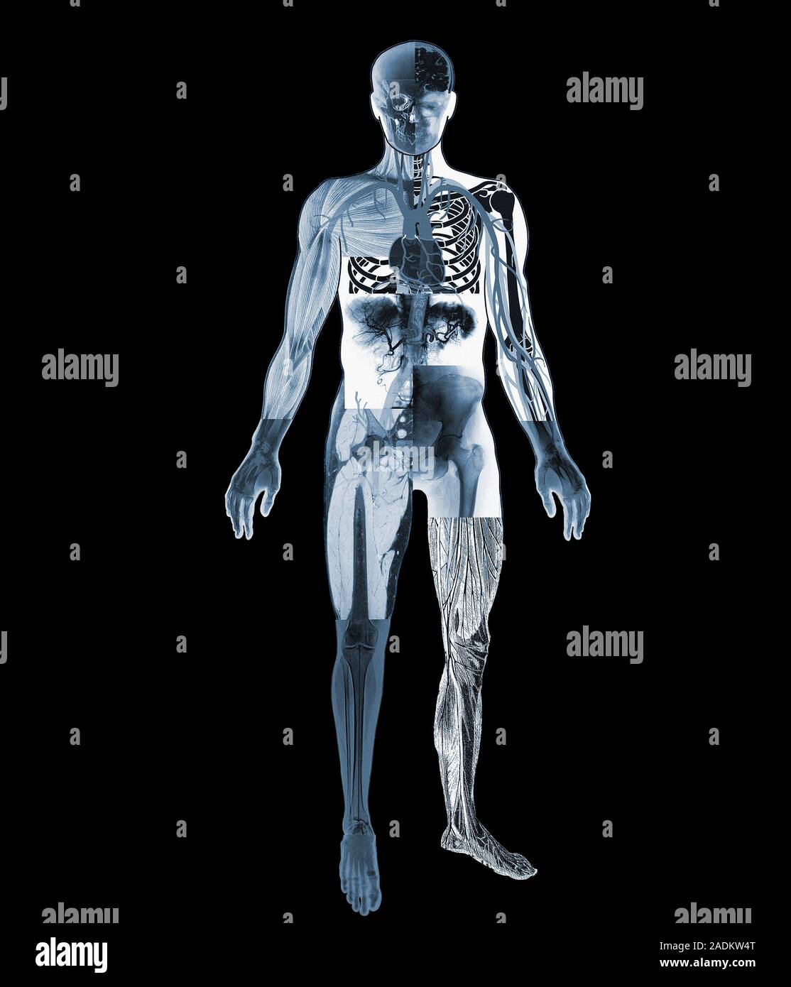 Body imaging. Composite image of several methods used to visualise the ...