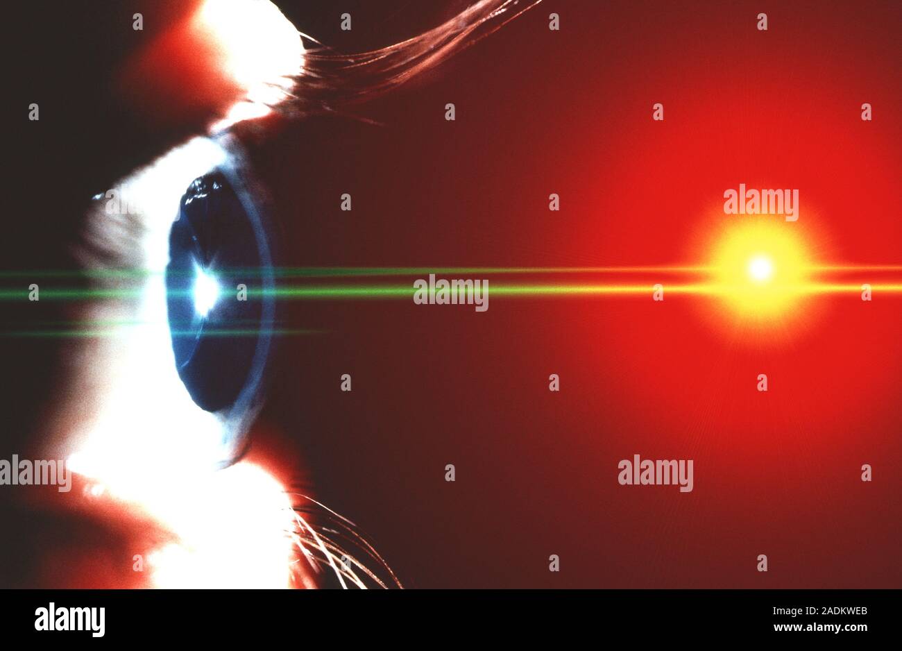Vision. Computer artwork of a human eye and laser beams. A laser ...