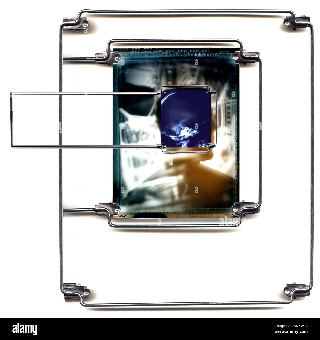 Diagnostic imaging. Conceptual computer artwork of a human figure with ...