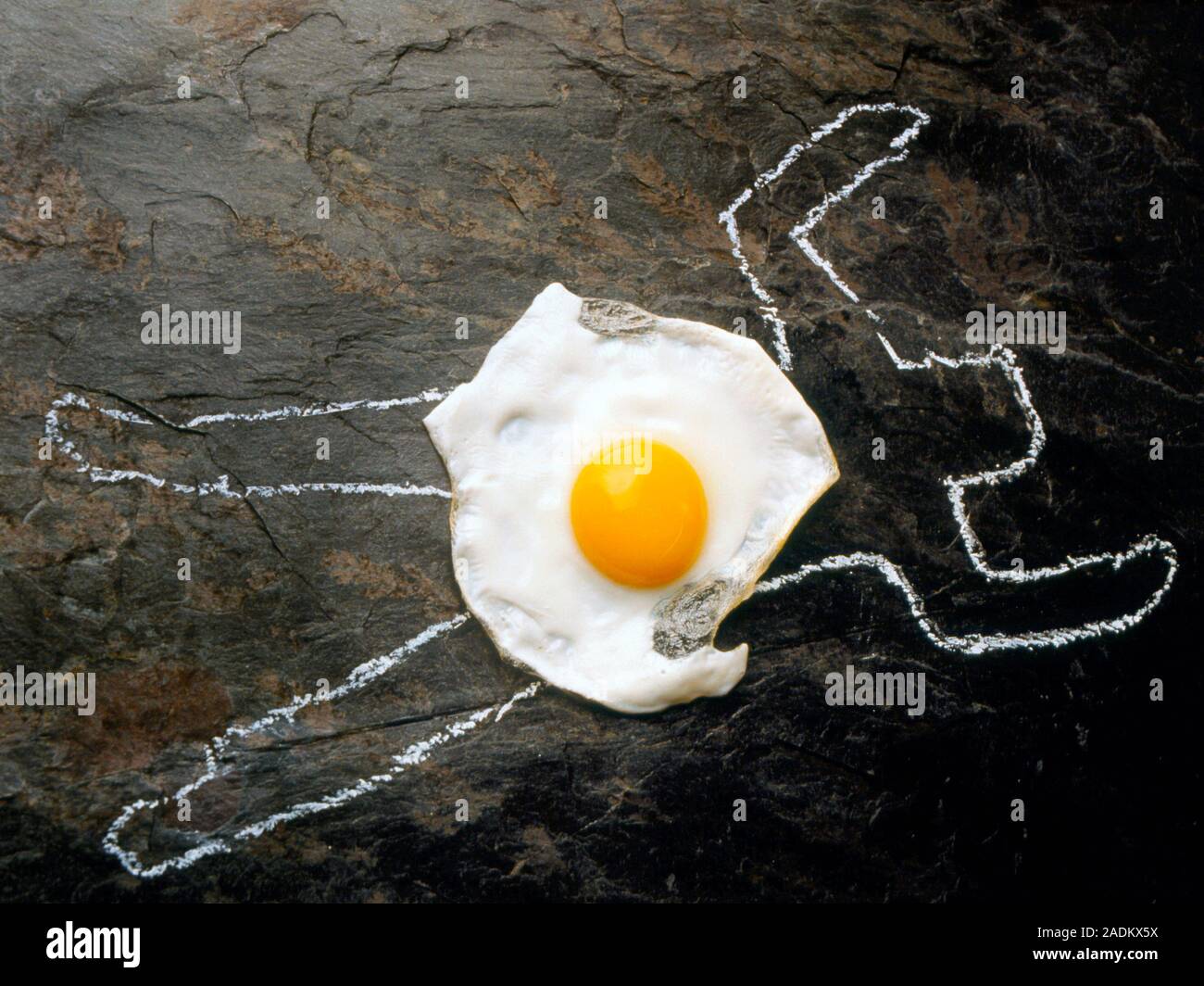Death from cholesterol. Abstract image showing the white outline of a ...