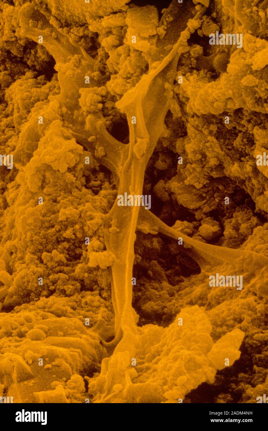 False-colour scanning electron micrograph of the surface of the ...