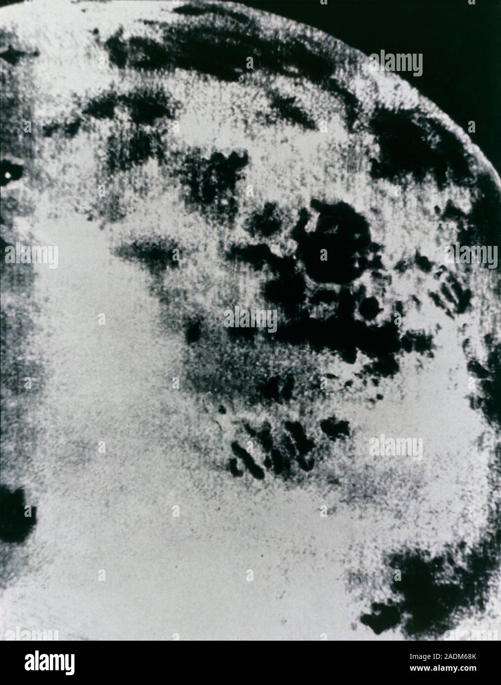 First image of the far side of the Moon. The first image returned by ...