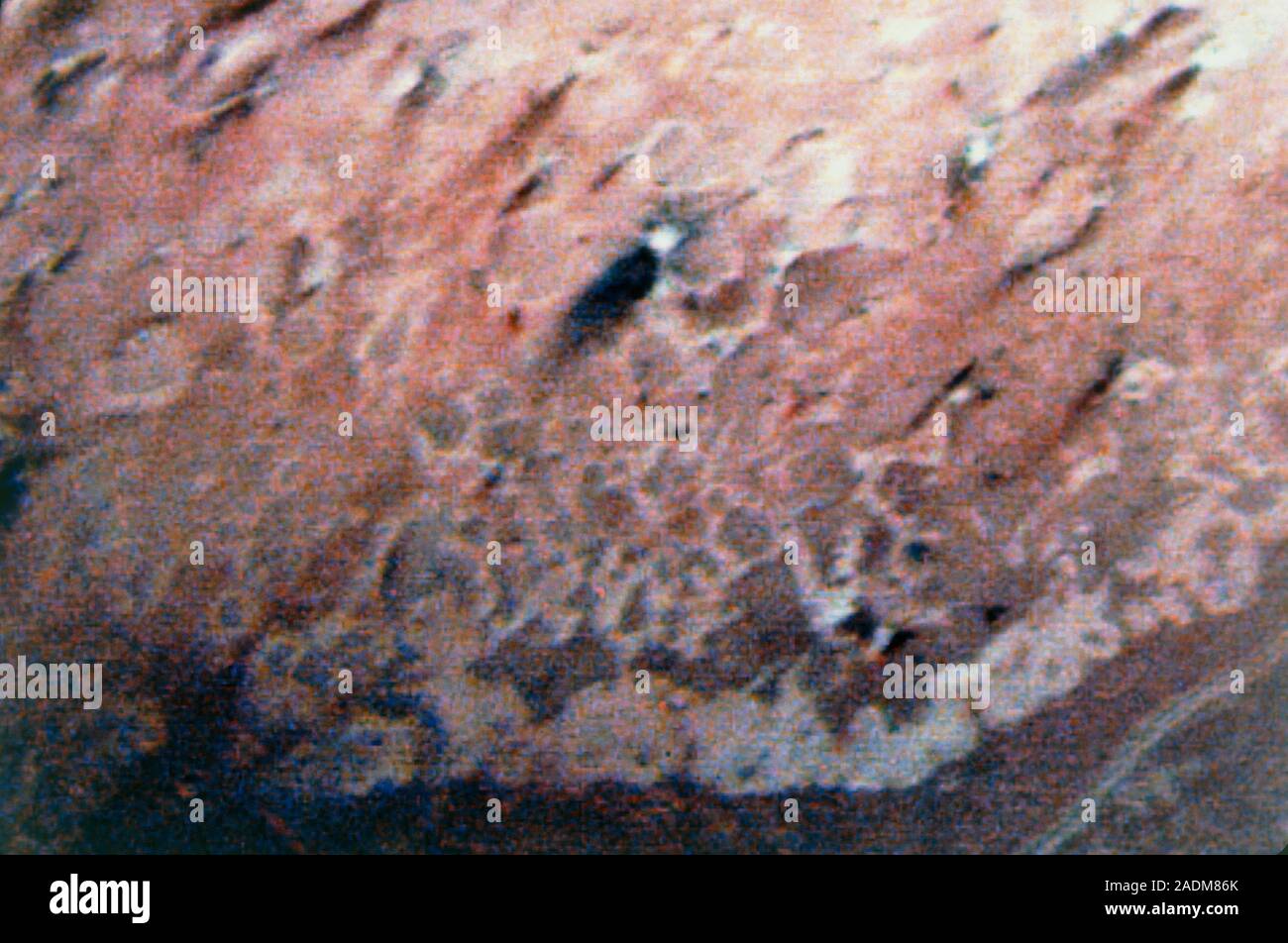 False-colour Voyager 2 image of Neptune's largest moon, Triton, showing ...