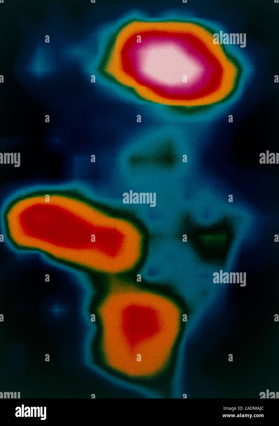 Infrared image of the BNKL star formation region in the Orion Nebula ...