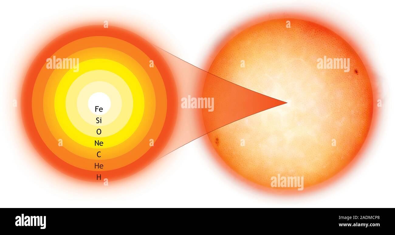 Supergiant star's core, artwork. When a supergiant star (10-70 solar ...