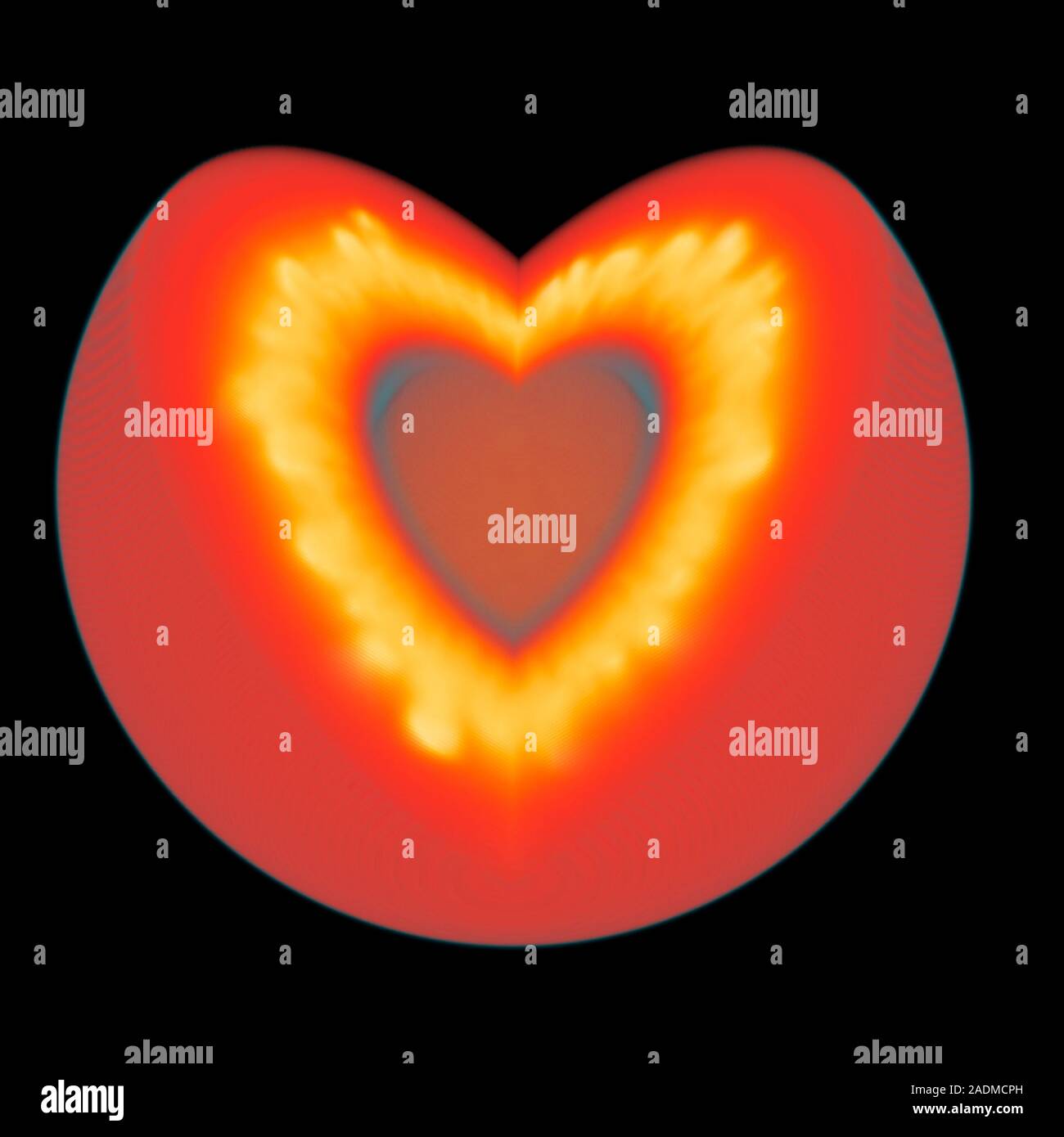 Supernova explosion. Image 1 of 4. Supercomputer simulation showing a ...