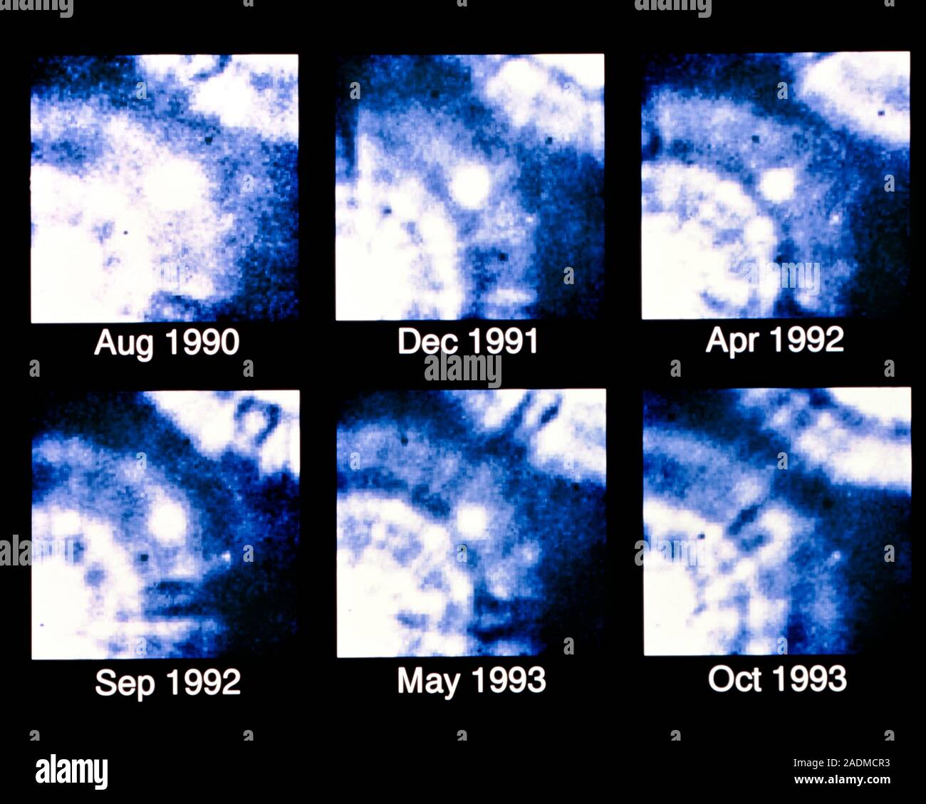 Supernova SN 1987A. Sequence of images taken in ultraviolet light by ...