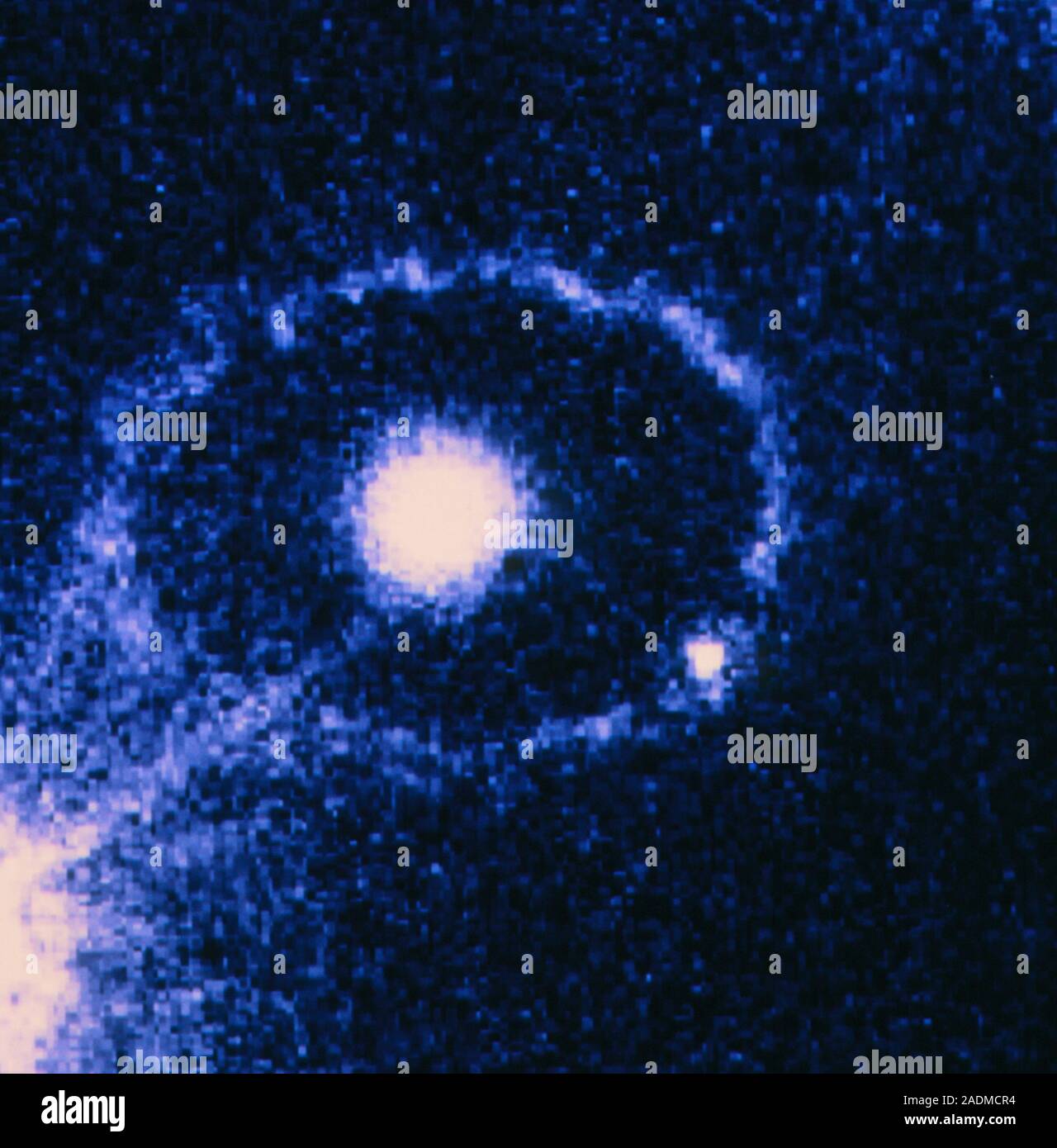 Supernova SN 1987A. Ultraviolet image taken by the Hubble Space ...