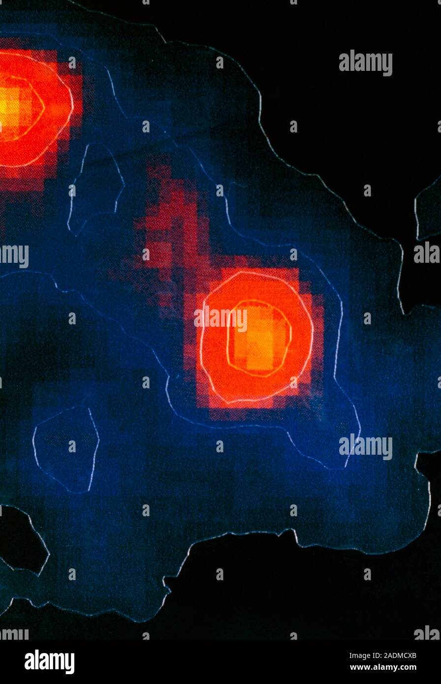 Gamma ray image of the Crab Nebula (centre) and the gamma ray source ...