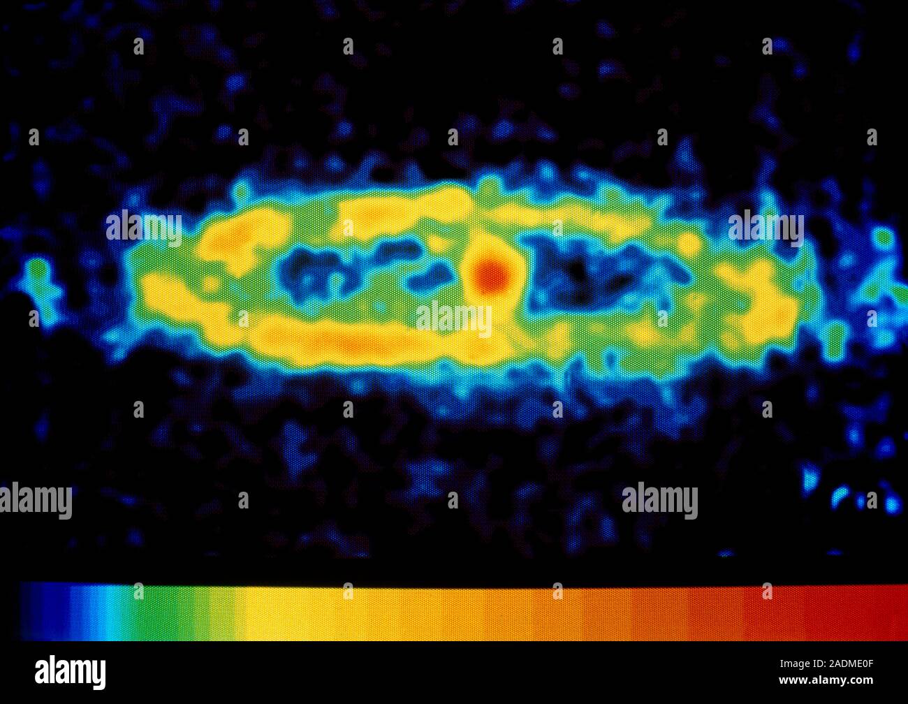Radio Image Of The Andromeda Galaxy M31 Made At The 11 Centimetre