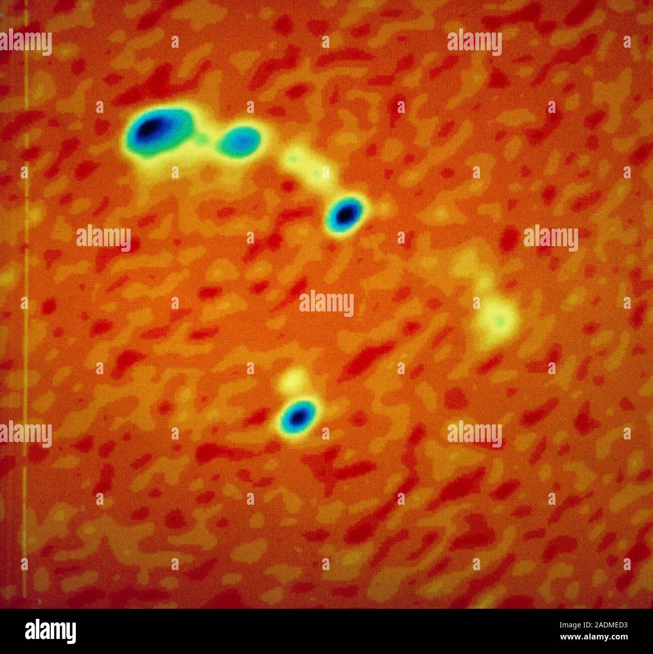 Radio map of the double quasar (0957+561), taken with the Very Large ...