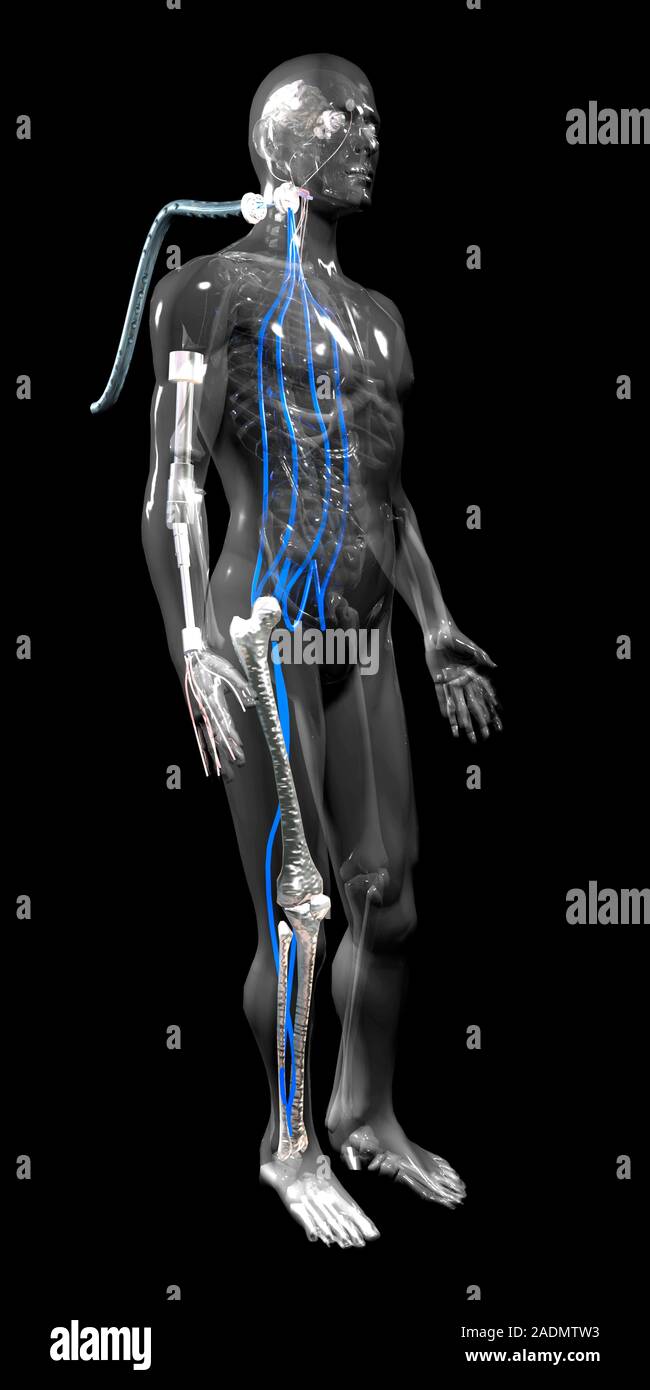 Cyborg, computer artwork. A cyborg or bionic man is an entity that is ...