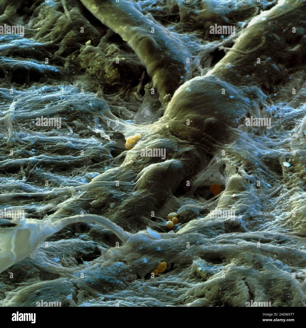 Contaminated banknote. Coloured scanning electron micrograph (SEM) of ...