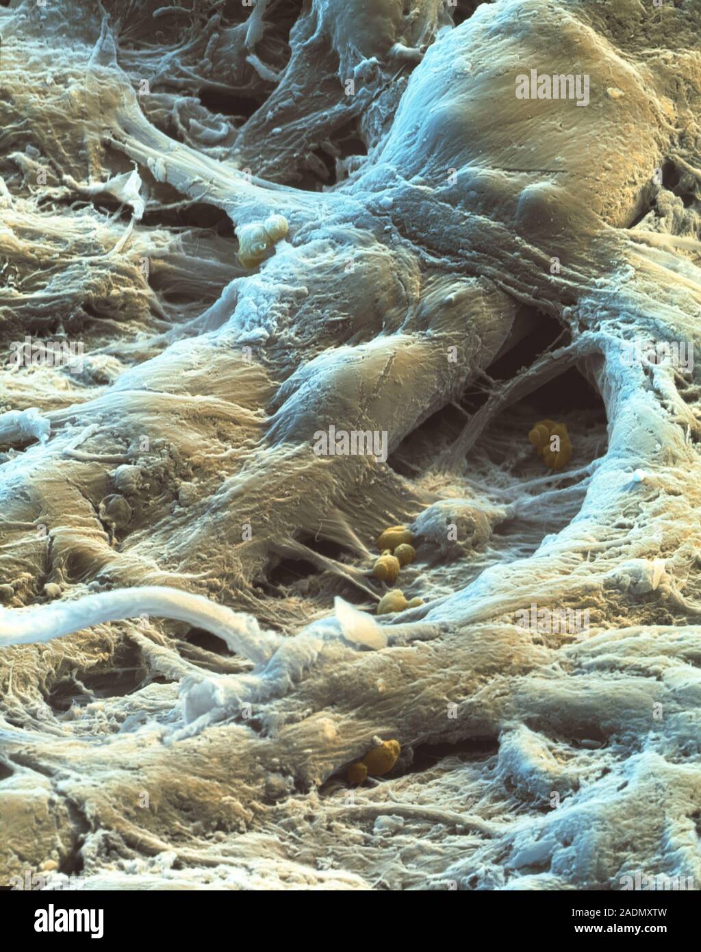 Contaminated banknote. Coloured scanning electron micrograph (SEM) of ...