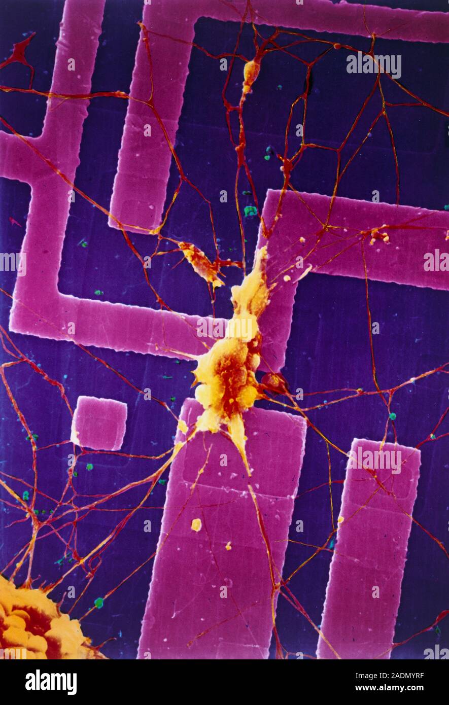 False-colour scanning electron micrograph (SEM) of human nerve cells ...