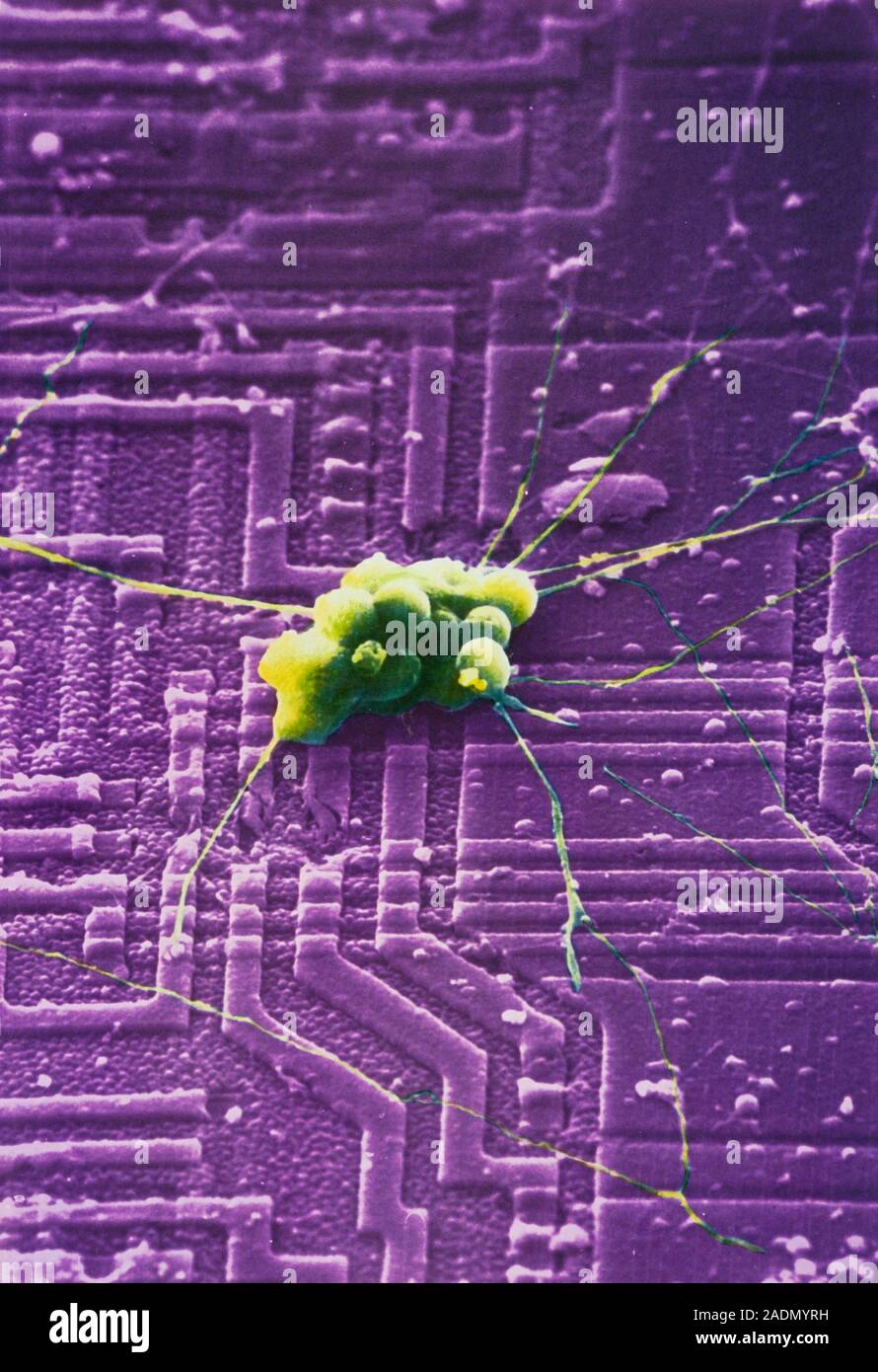 False-colour scanning electron micrograph (SEM) of human nerve cells ...