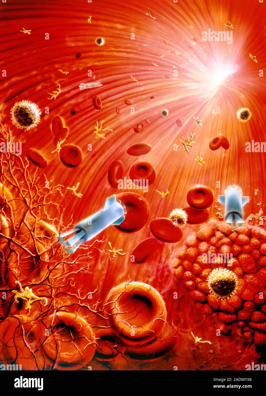 Nanorobots. Illustration of nanorobots destroying diseased tissue ...