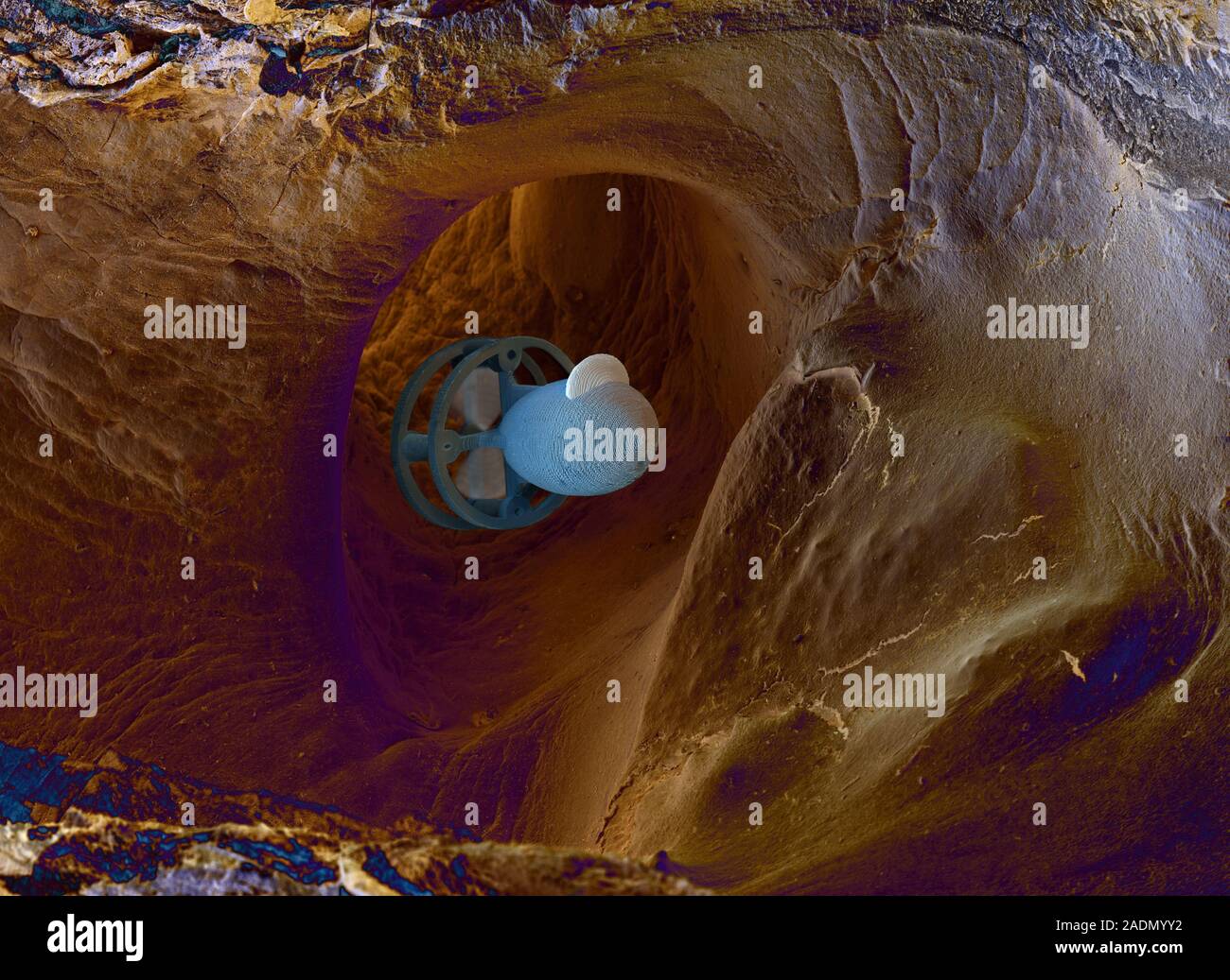 Micro-submarine in artery. Conceptual coloured scanning electron ...