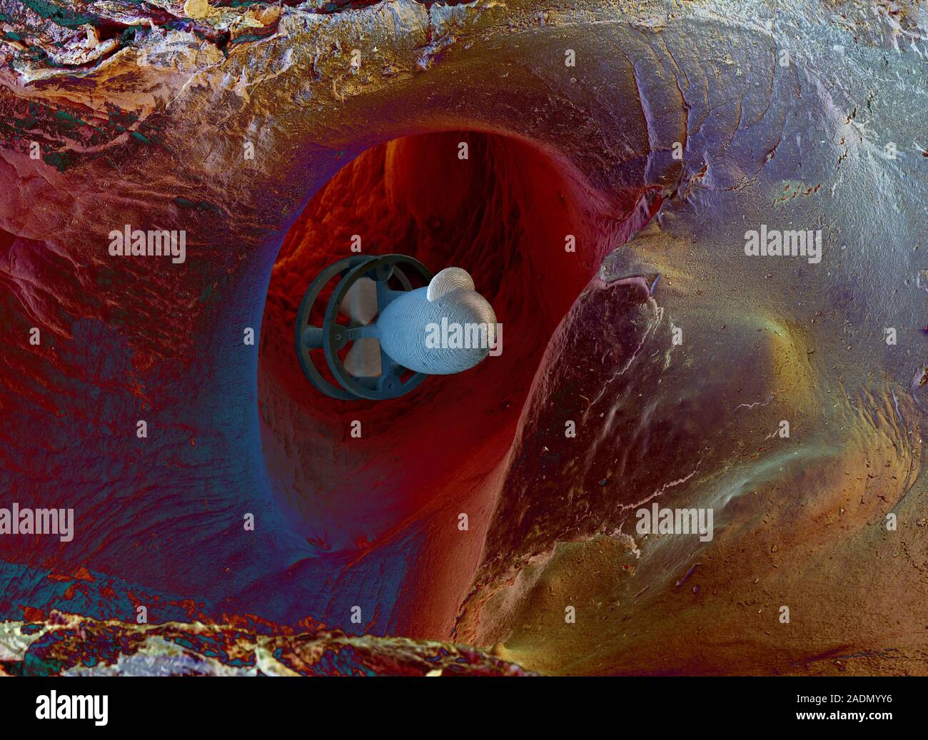Micro-submarine in artery. Conceptual coloured scanning electron ...