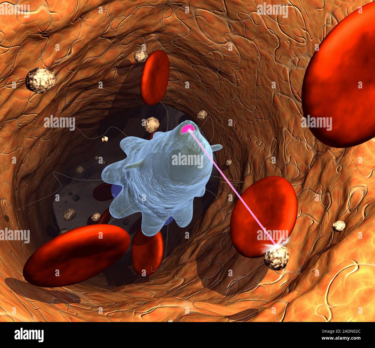 Medical nanorobot. Computer artwork of a nanorobot using a laser to ...