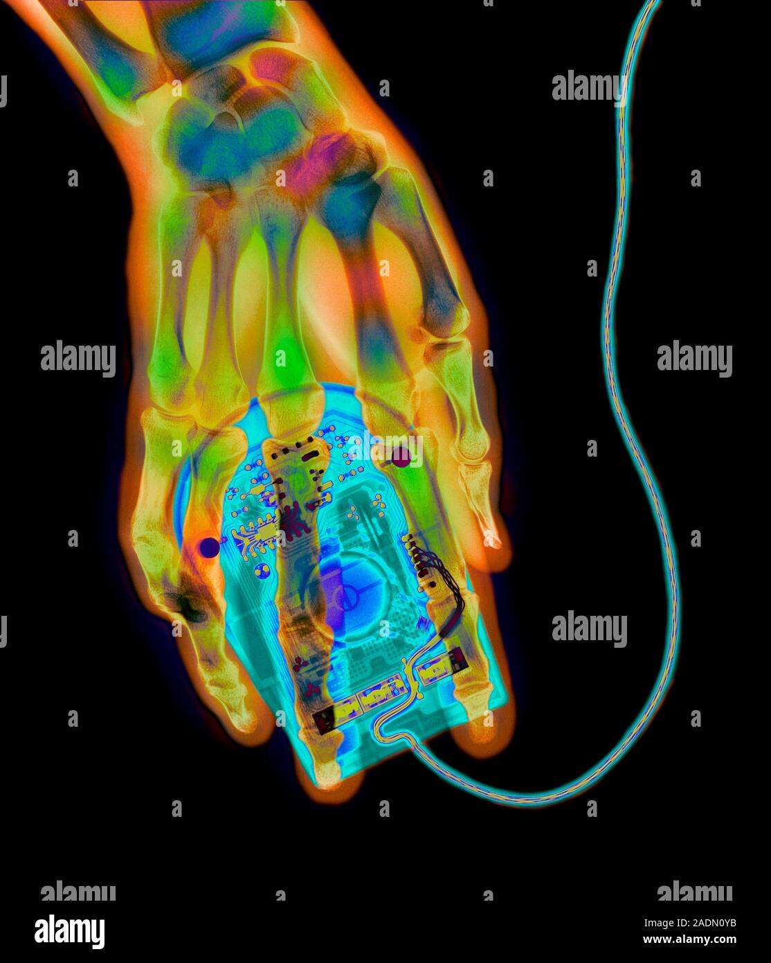 Computer mouse. Coloured X-ray of a computer mouse being held and ...