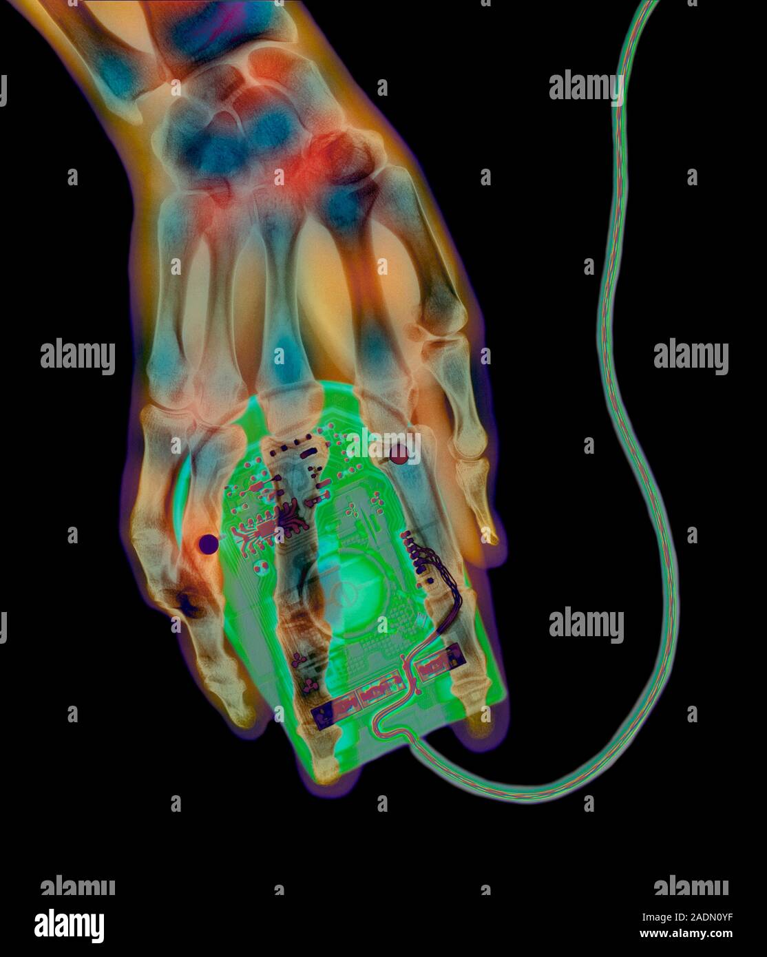 Computer mouse. Coloured X-ray of a computer mouse being held and ...