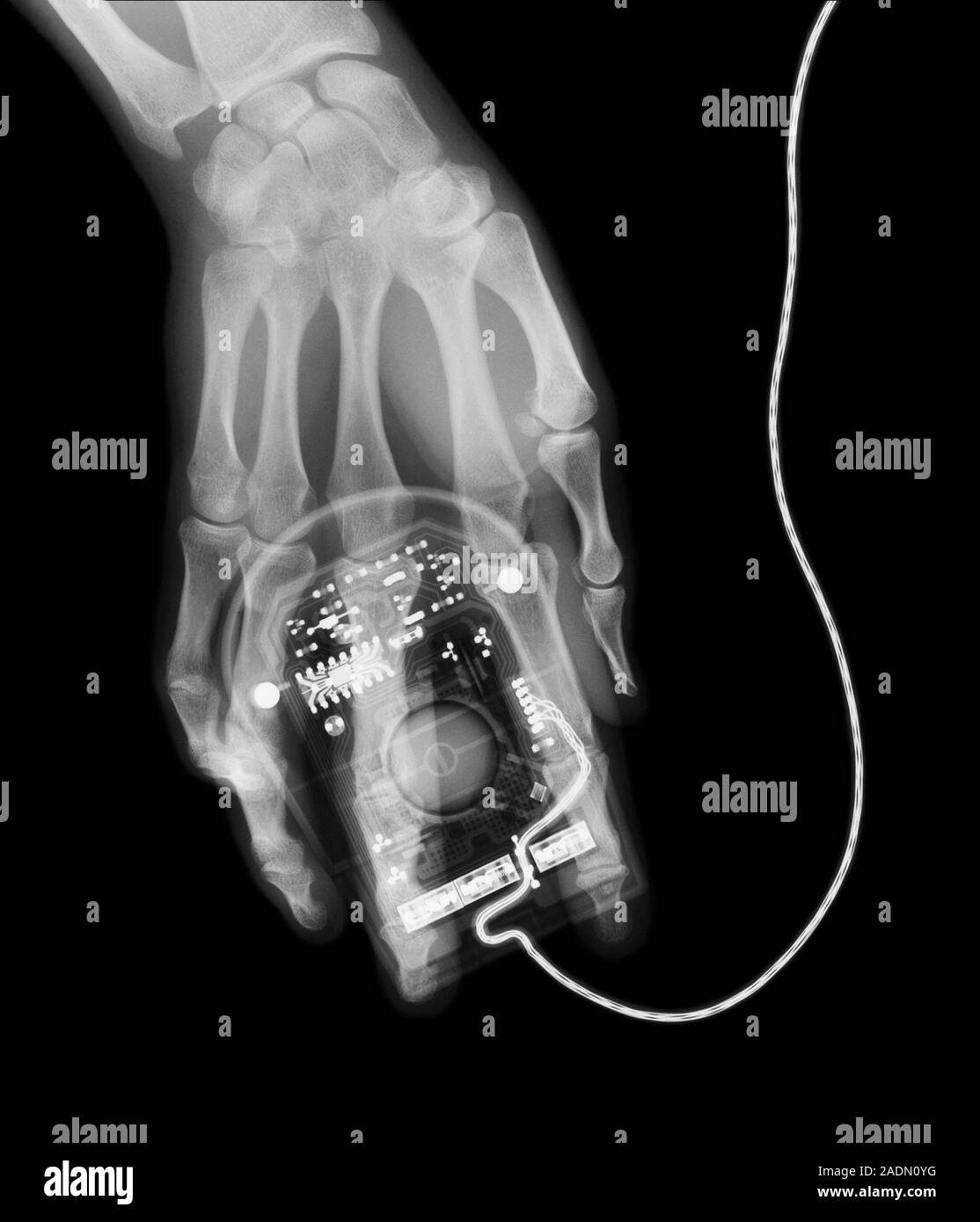 Computer mouse. X-ray of a computer mouse being held and operated by a ...