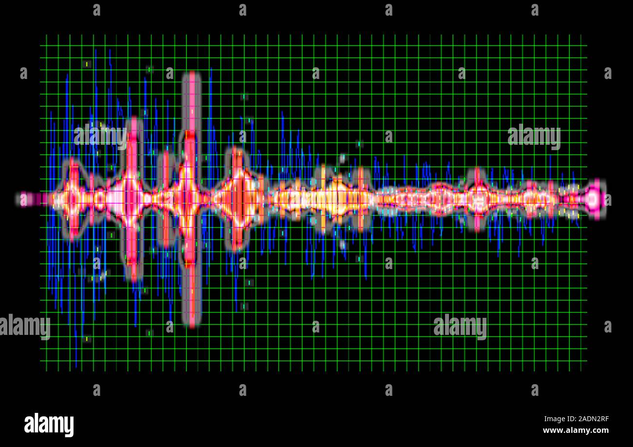 Voice recognition. Conceptual computer artwork of voice patterns (jagged waveforms ...