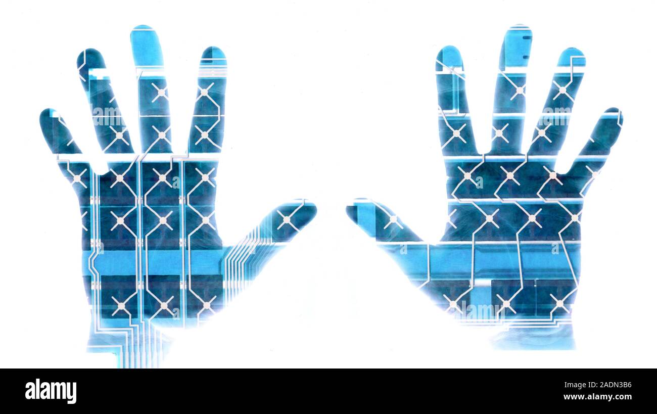 Cybernetic hands. Conceptual computer artwork of hands covered in ...