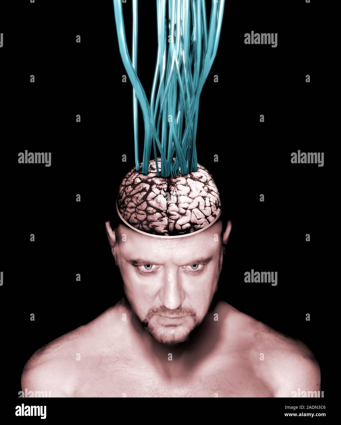 Wired brain. Computer artwork of a human brain connected to wires. This ...