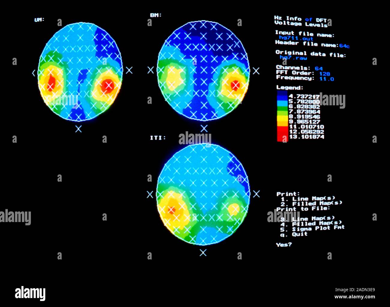 Brain-activated technology. Three maps of brain electrical activity at ...