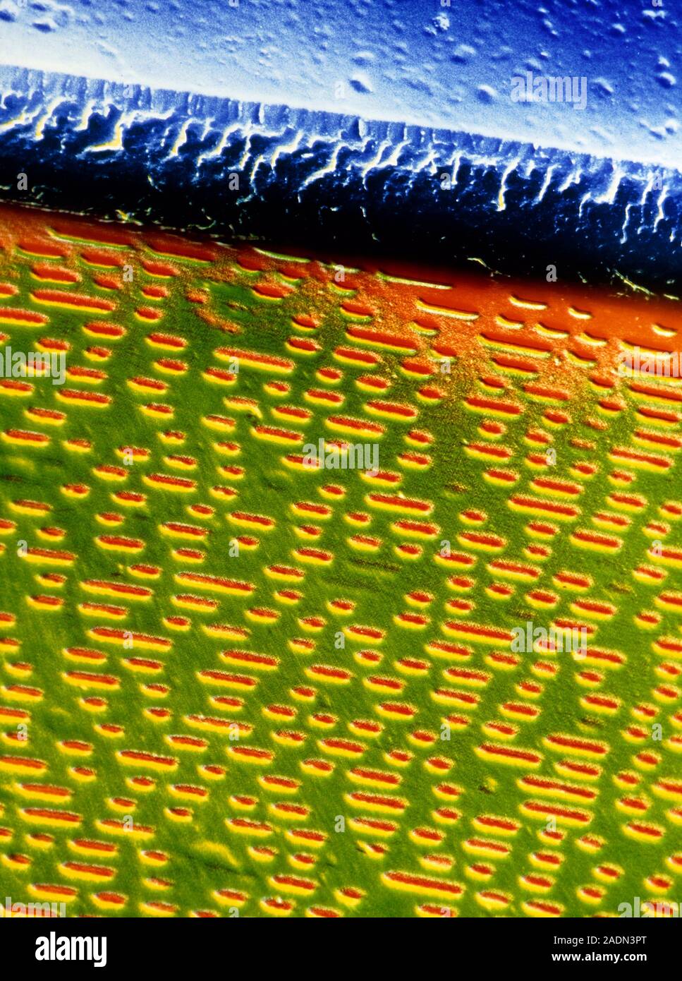 False-colour scanning electron micrograph (SEM) of the surface of a ...