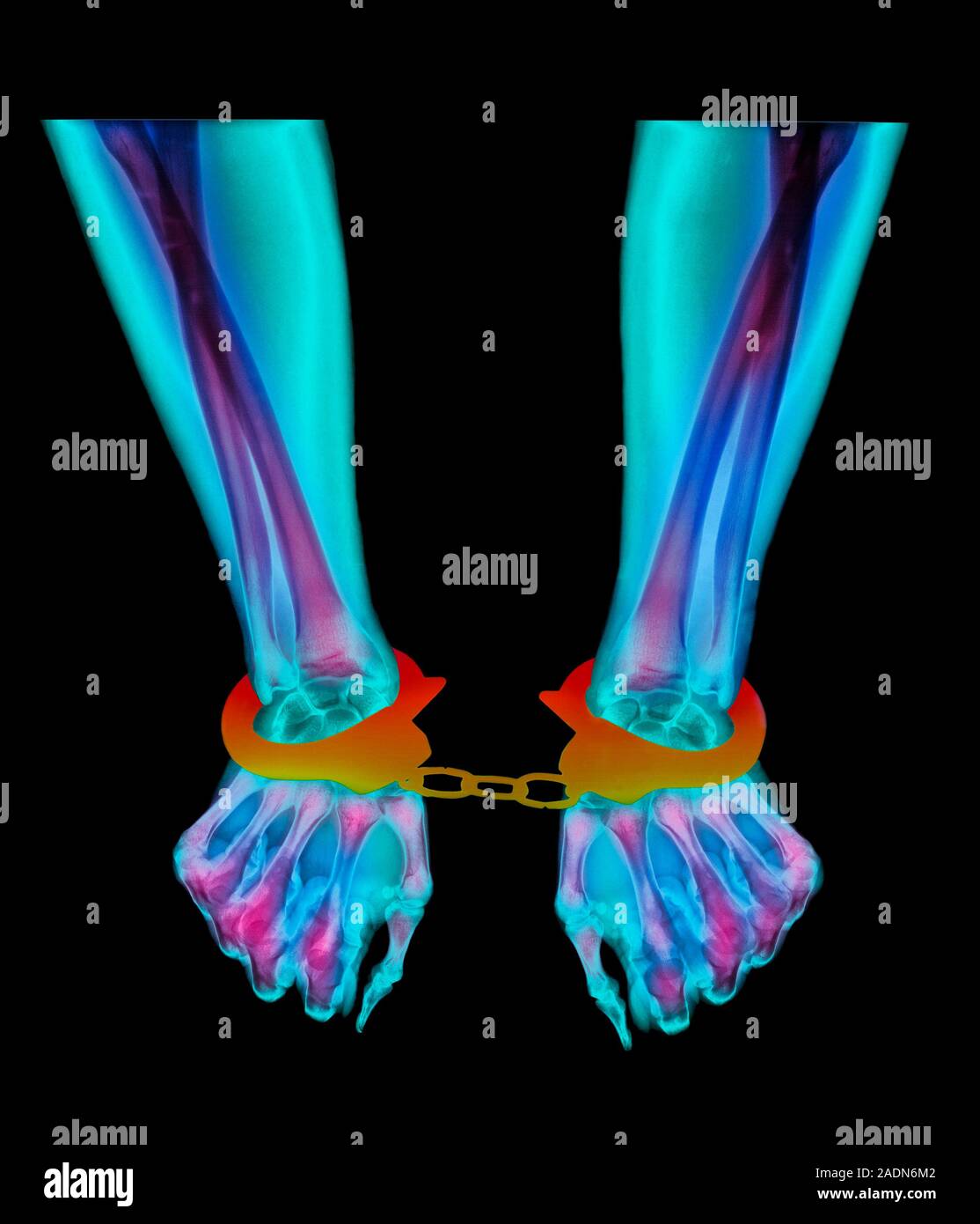 Handcuffed hands. Coloured X-ray of handcuffed hands. Handcuffs are ...