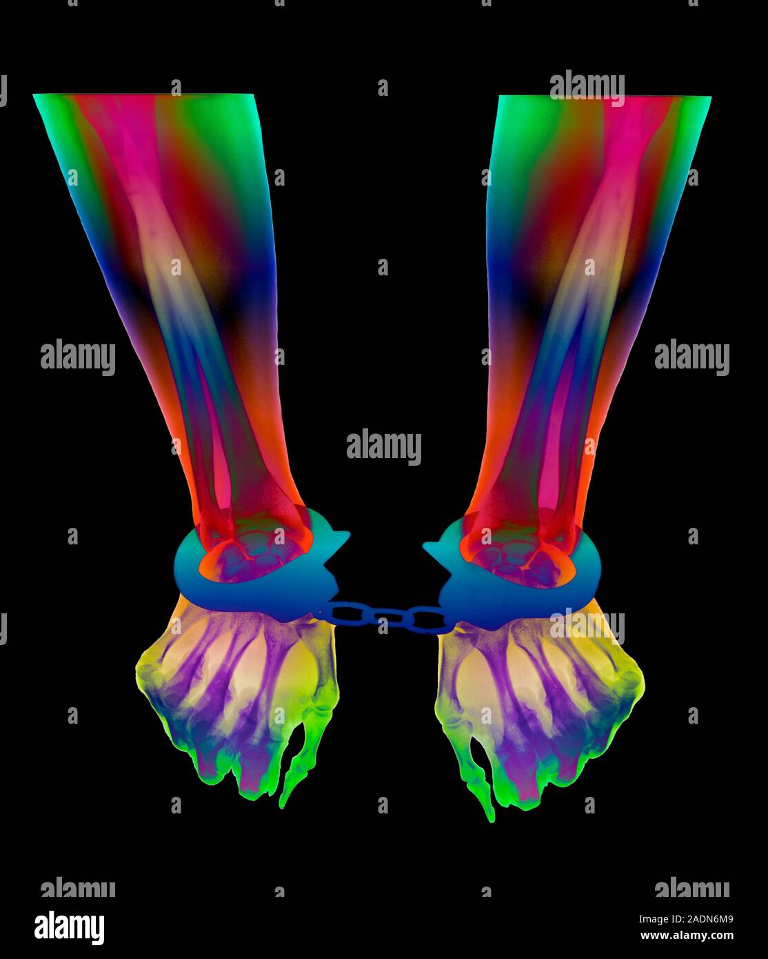 Handcuffed hands. Coloured X-ray of handcuffed hands. Handcuffs are ...