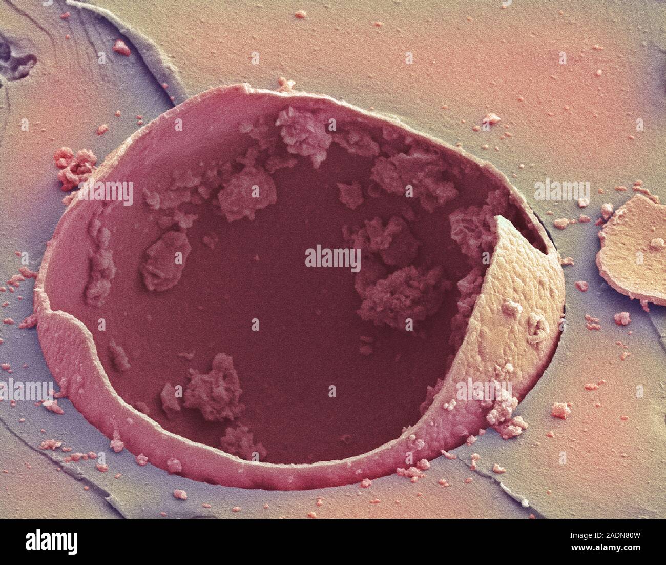 Self-healing plastic. Coloured scanning electron micrograph (SEM) of a ...