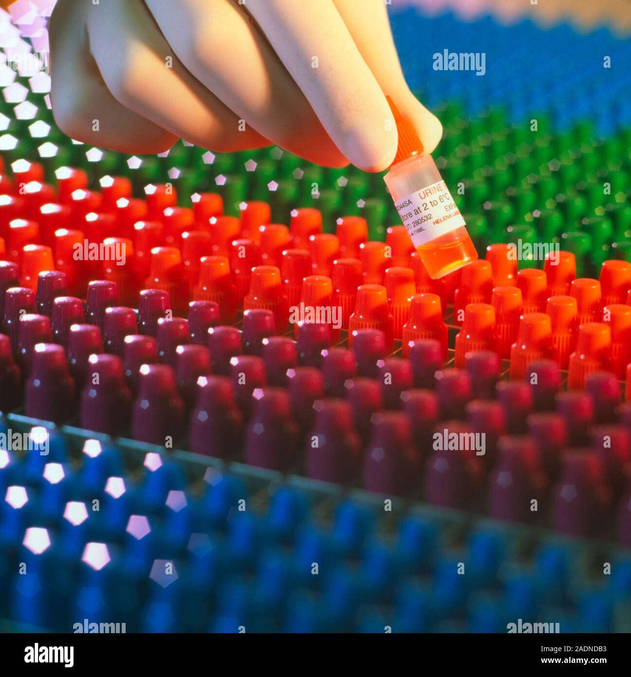 Immunoassay kit manufacture. Gloved hand holding a phial during ...