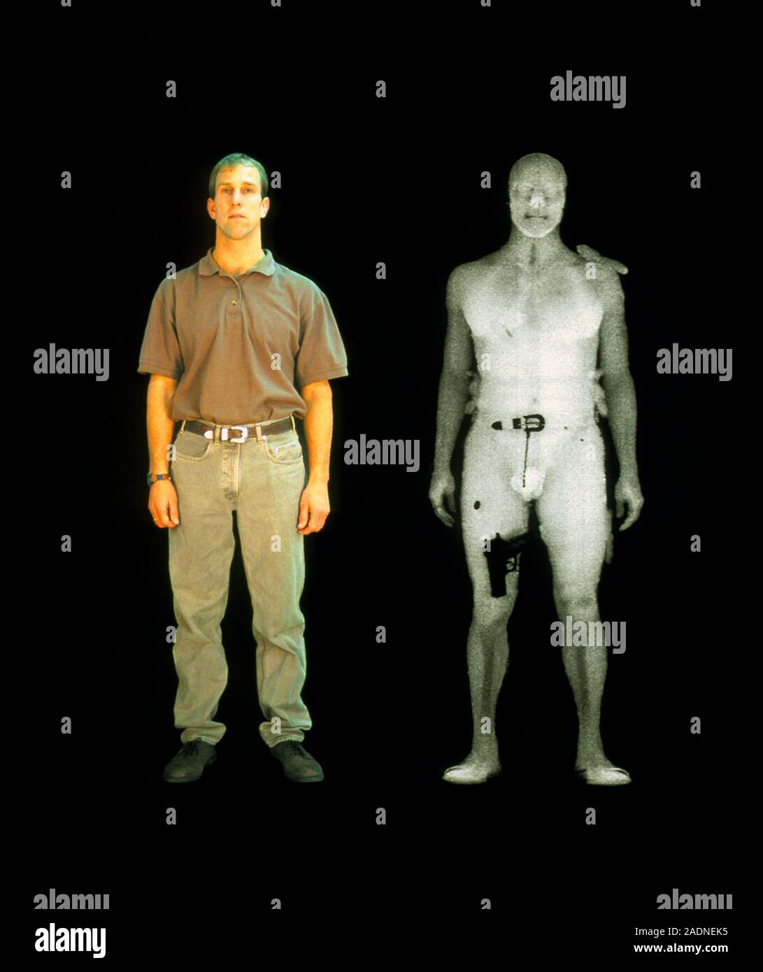 BodySearch X-ray surveillance. Front X-ray view of a male subject ...