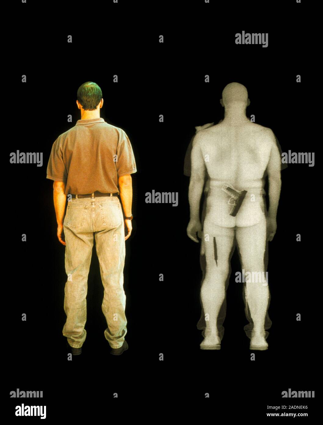 BodySearch X-ray surveillance. Rear X-ray view of a male subject during ...