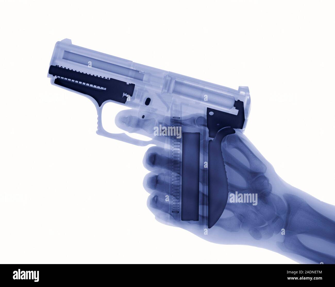 Handgun, X-ray. Hand holding a Walther P99 semi- automatic pistol. The ...