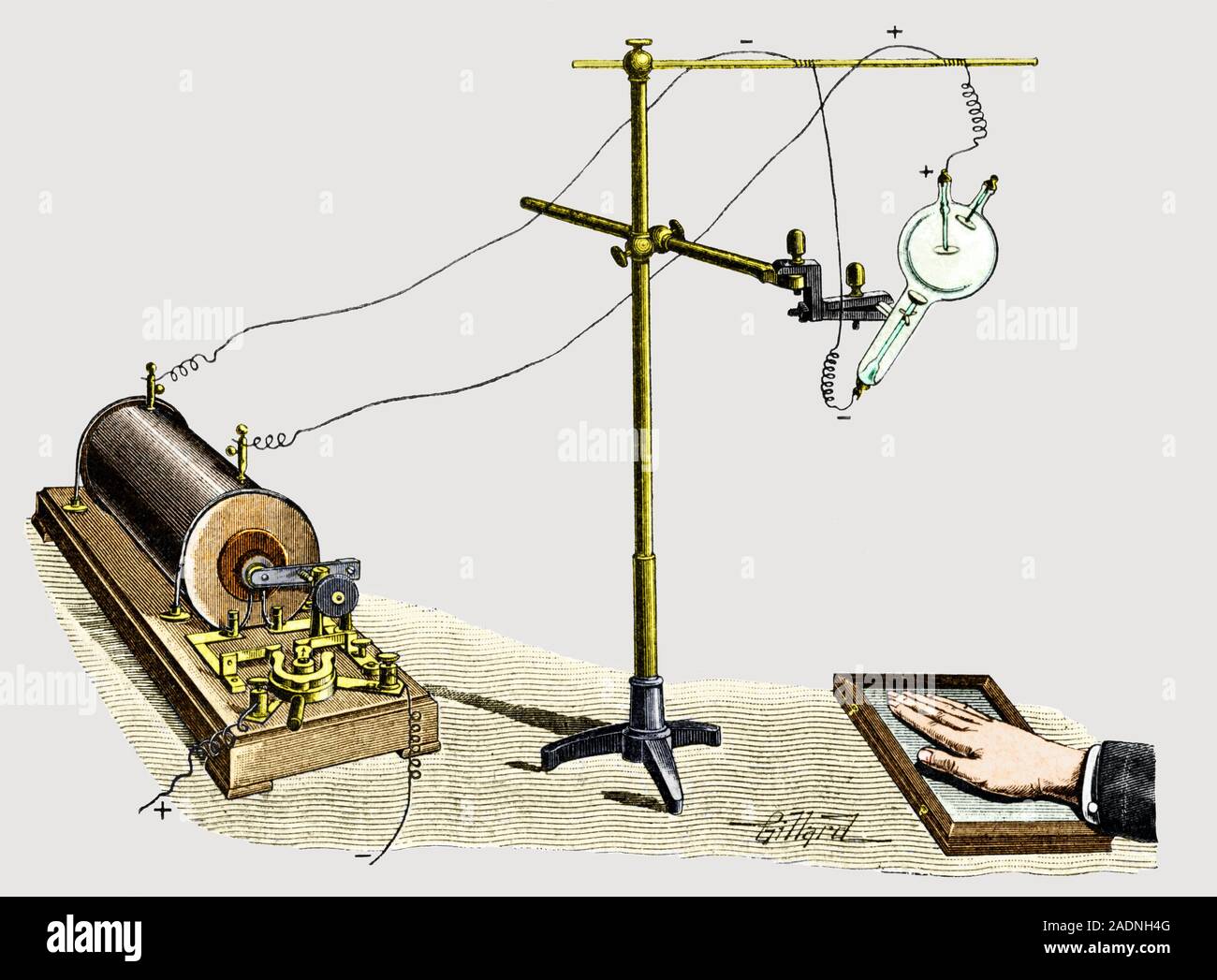 Early radiography experiment. Historical artwork of a Ruhmkorff ...