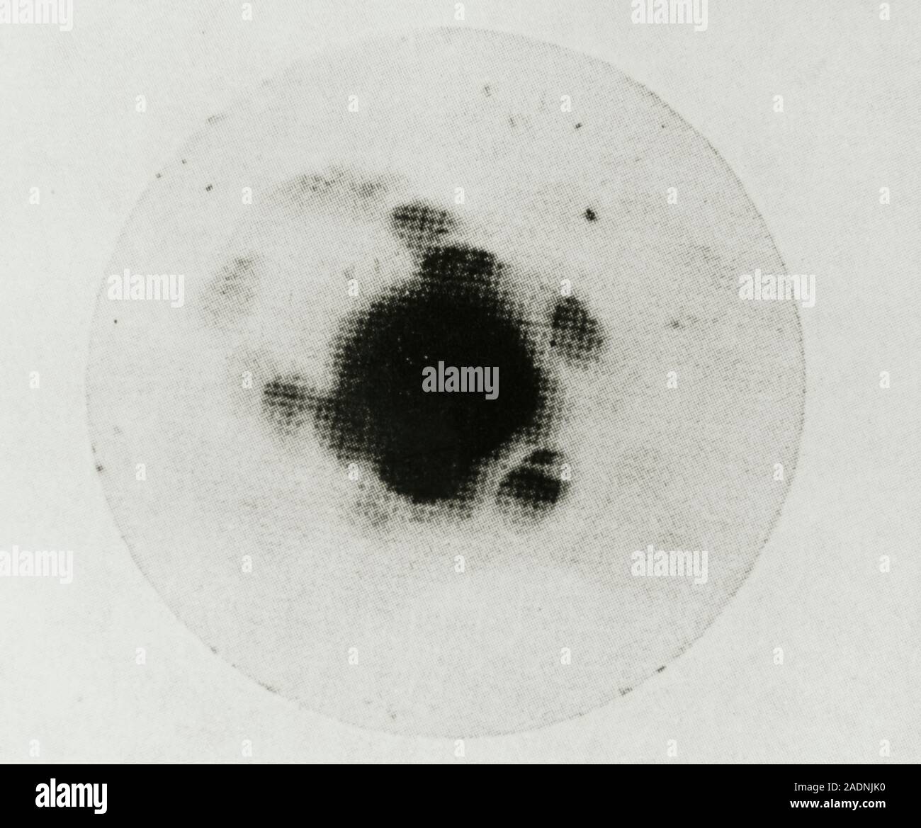 First X-ray diffraction photograph. The first ever X-ray crystal ...
