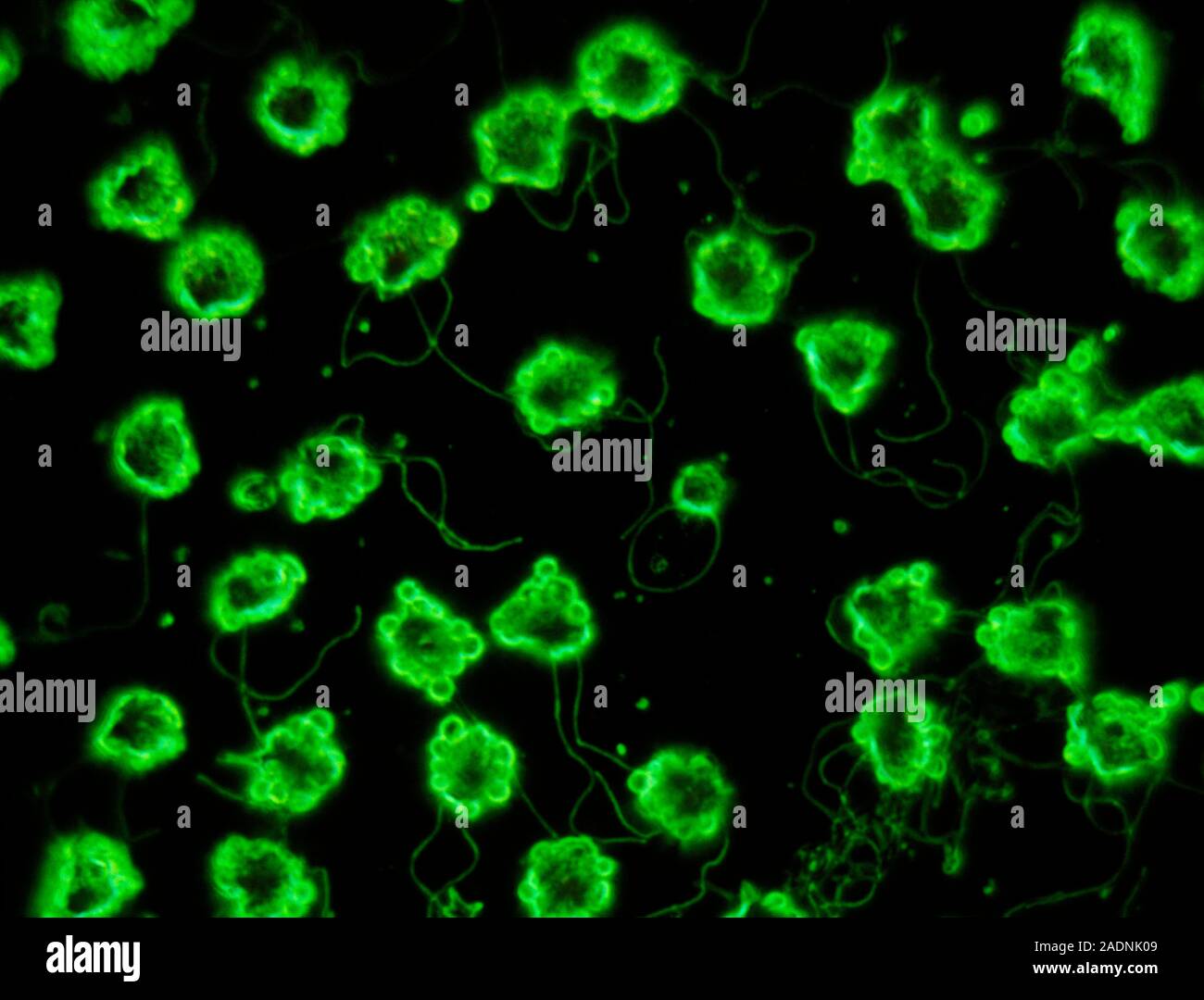 Light micrograph of a colony of Volvox sp. Volvox is an organism that ...