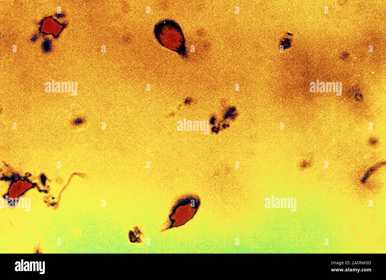 Giardia lamblia. Coloured light micrograph of the protozoan Giardia ...
